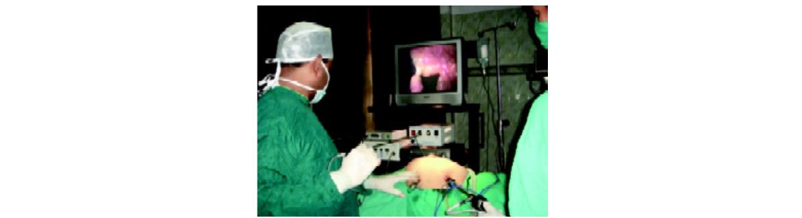 Two Port Repair of Ventral Hernia