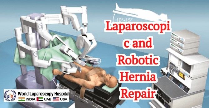 Laparoscopic and Robotic Hernia Repair TAP, TEPP and other