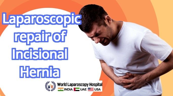 Questions about Laparoscopic repair of Incisional Hernia