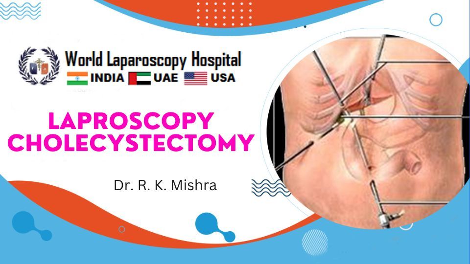 Laparoscopic Cholecystectomy Video
