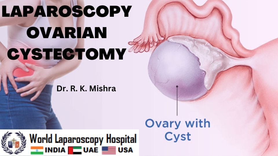 How To Perform Laparoscopic Ovarian Cystectomy Step By Step What Are